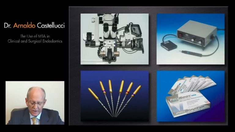 The use of MTA in Clinical and Surgical Endodontics – VIDEdental